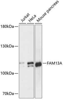 FAM13A Antibody - Cat. No. 15-612 | ProSci