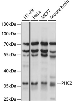PHC2 Antibody - Cat. No. 15-688 | ProSci