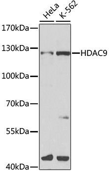 HDAC9 Antibody - Cat. No. 15-907 | ProSci