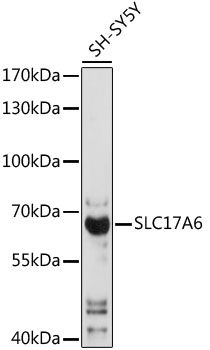 SLC17A6 Antibody - Cat. No. 15-915 | ProSci
