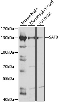 SAFB Antibody - Cat. No. 16-198 | ProSci