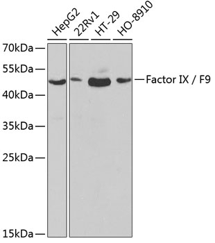 Factor IX / F9 Antibody - Cat. No. 16-228 | ProSci