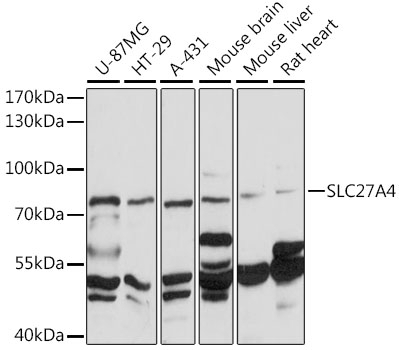 SLC27A4 Antibody - Cat. No. 16-430 | ProSci