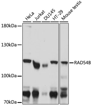 RAD54B Antibody - Cat. No. 16-491 | ProSci