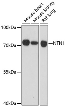 NTN1 Antibody - Cat. No. 16-506 | ProSci