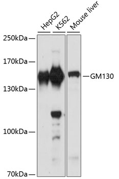 GM130 Antibody - Cat. No. 16-510 | ProSci