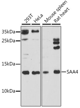 SAA4 Antibody - Cat. No. 16-598 | ProSci