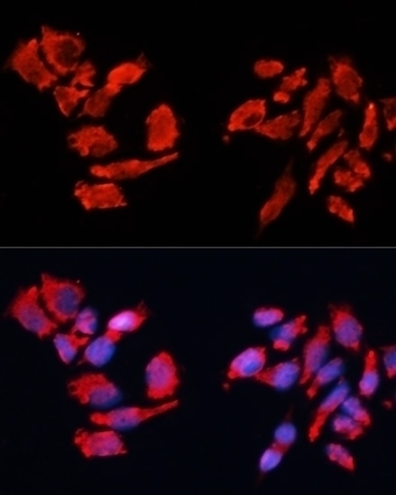 CA9 Antibody - Cat. No. 16-663 | ProSci