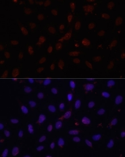 COL1A1 Antibody - Cat. No. 16-789 | ProSci