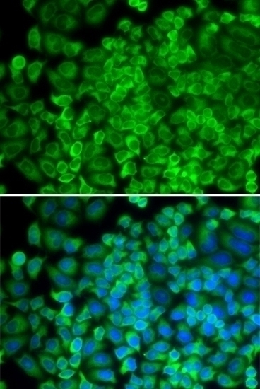 GLA Antibody - Cat. No. 16-829 | ProSci
