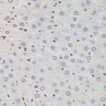 AKAP8 Antibody - Cat. No. 16-909 | ProSci