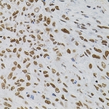 AKAP8 Antibody - Cat. No. 16-909 | ProSci