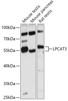 LPCAT3 Antibody - Cat. No. 16-999 | ProSci