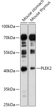 PLEK2 Antibody - Cat. No. 18-043 | ProSci