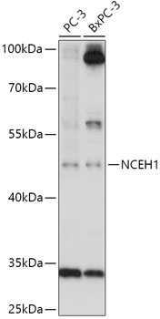 NCEH1 Antibody - Cat. No. 18-083 | ProSci