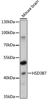 HSD3B7 Antibody - Cat. No. 18-097 | ProSci