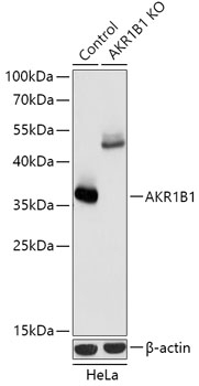 AKR1B1 Antibody, KO Validated - Cat. No. 18-219 | ProSci