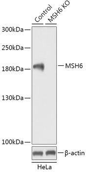 MSH6 Antibody, KO Validated - Cat. No. 18-253 | ProSci