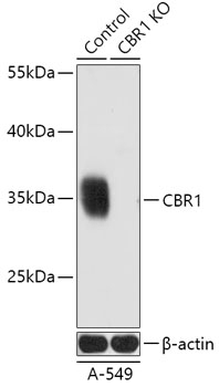 CBR1 Antibody, KO Validated - Cat. No. 18-264 | ProSci