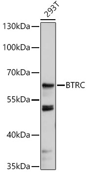 BTRC Antibody - Cat. No. 18-324 | ProSci