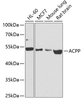 ACPP Antibody - Cat. No. 18-400 | ProSci