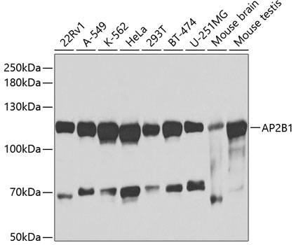 AP2B1 Antibody - Cat. No. 18-434 | ProSci