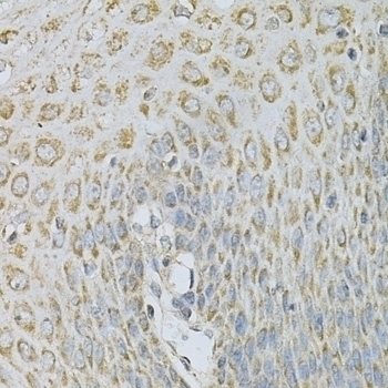 AP2B1 Antibody - Cat. No. 18-434 | ProSci