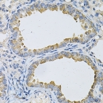 AP2B1 Antibody - Cat. No. 18-434 | ProSci