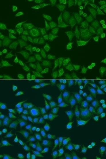 RPS27A Antibody - Cat. No. 18-452 | ProSci