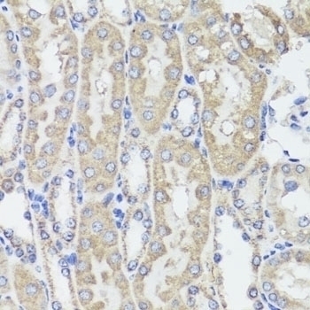 KLK3 Antibody - Cat. No. 18-468 | ProSci