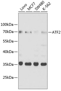 ATF2 Antibody - Cat. No. 18-540 | ProSci