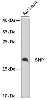 BNP Antibody - Cat. No. 18-554 | ProSci