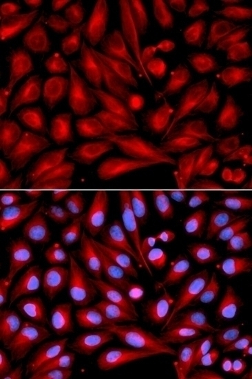 MAP2K7 Antibody - Cat. No. 18-560 | ProSci