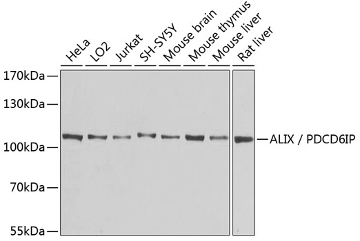 ALIX / PDCD6IP Antibody - Cat. No. 18-578 | ProSci