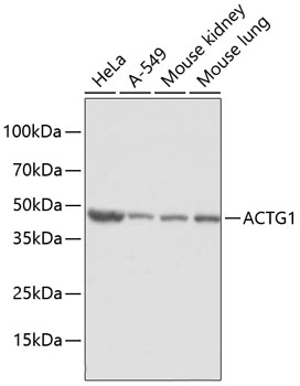 ACTG1 Antibody - Cat. No. 18-745 | ProSci