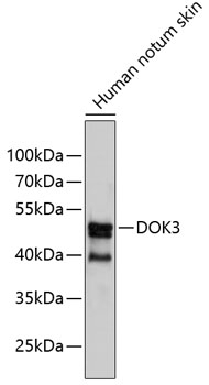 DOK3 Antibody - Cat. No. 18-782 | ProSci