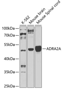 ADRA2A Antibody - Cat. No. 18-821 | ProSci