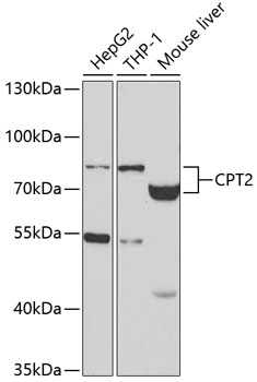 CPT2 Antibody - Cat. No. 18-843 | ProSci