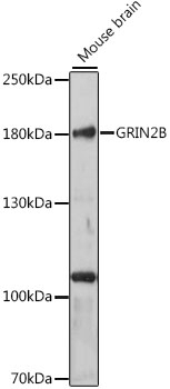 GRIN2B Antibody - Cat. No. 18-922 | ProSci