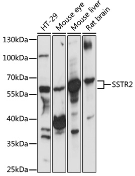 SSTR2 Antibody - Cat. No. 18-958 | ProSci
