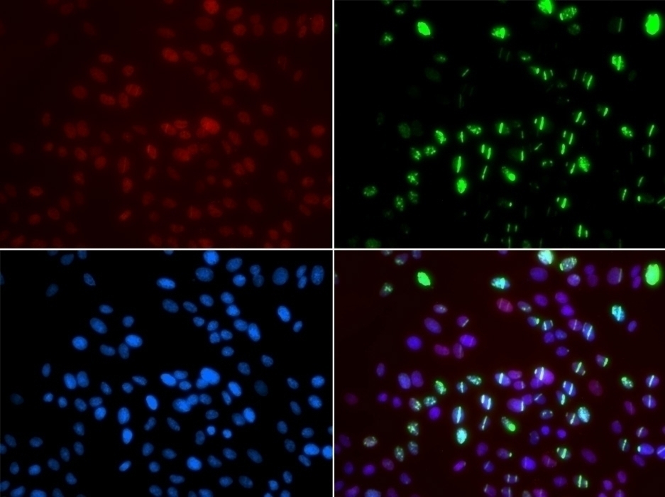 MSH6 Antibody - Cat. No. 18-979 | ProSci