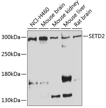 SETD2 Antibody - Cat. No. 18-990 | ProSci