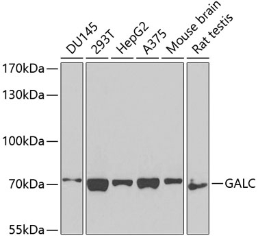 GALC Antibody - Cat. No. 19-192 | ProSci