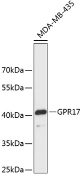 GPR17 Antibody - Cat. No. 19-203 | ProSci