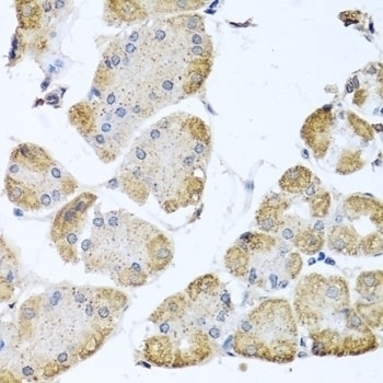 ITPKB Antibody - Cat. No. 19-219 | ProSci