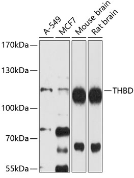 THBD Antibody - Cat. No. 19-294 | ProSci