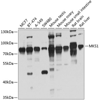 MKS1 Antibody - Cat. No. 19-473 | ProSci