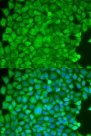 SGCE Antibody - Cat. No. 19-593 | ProSci