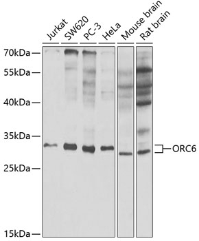 ORC6 Antibody - Cat. No. 19-655 | ProSci
