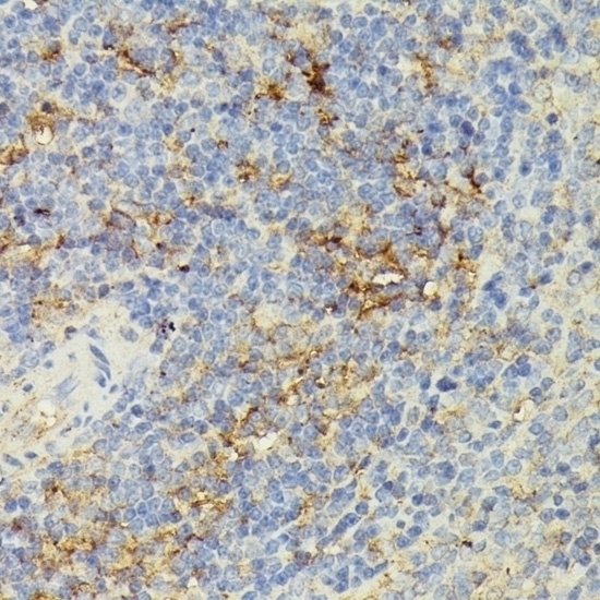 ECE1 Antibody - Cat. No. 19-770 | ProSci